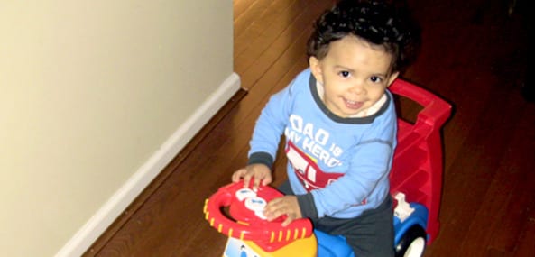 Mehta Casting for Infantile Scoliosis | Hector's Story