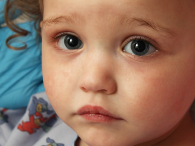 Wheezing in Kids: When to Call a Doctor