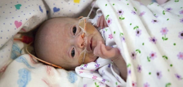 Premature Birth: 6 Factors That Can Increase The Risk